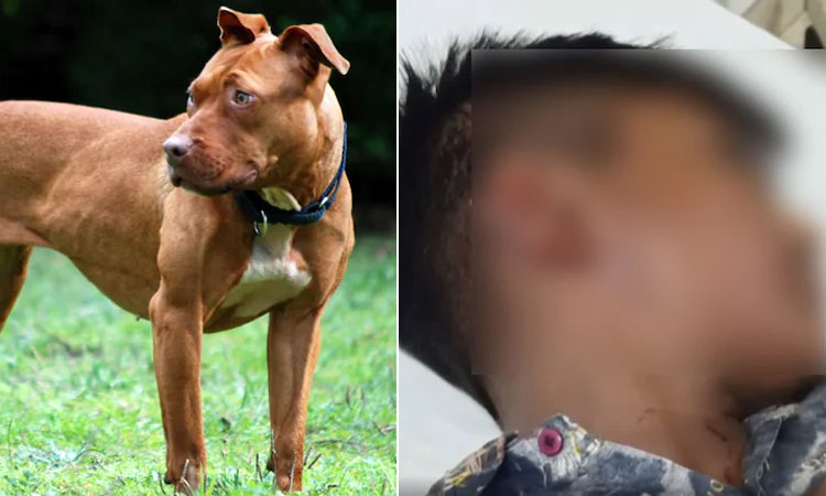 13-year-old boy left with mangled ear after pitbull attack in Punjab's ...