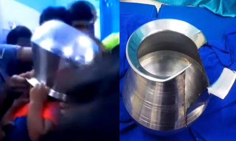 A pot stuck on a child's head | ராணிப்பேட்டை: ஒன்றரை வயது குழந்தையின் ...