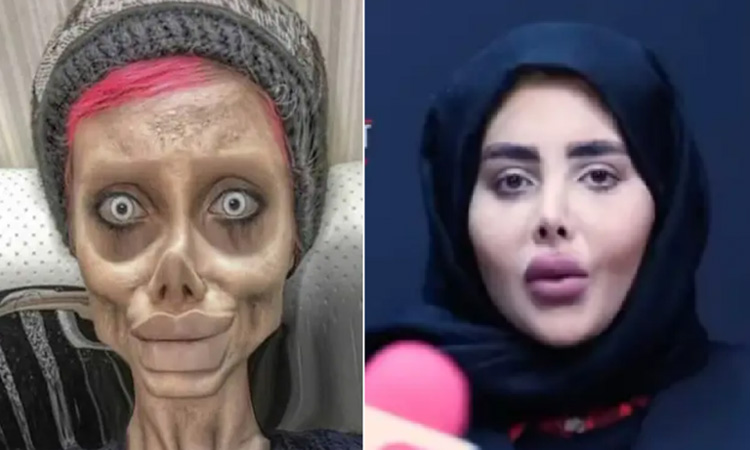 Iranian 'Zombie Angelina Jolie' looked like a normal girl in a TV ...